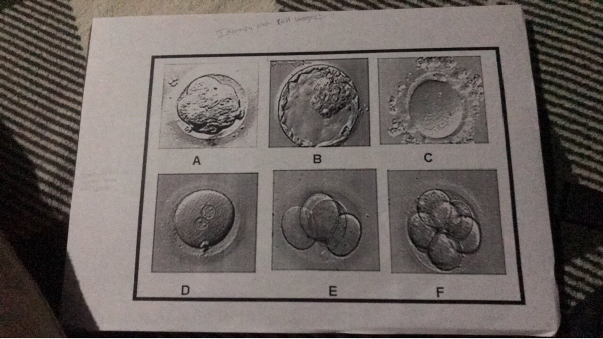 Identify each cell stage shown in the diagrams. | Filo