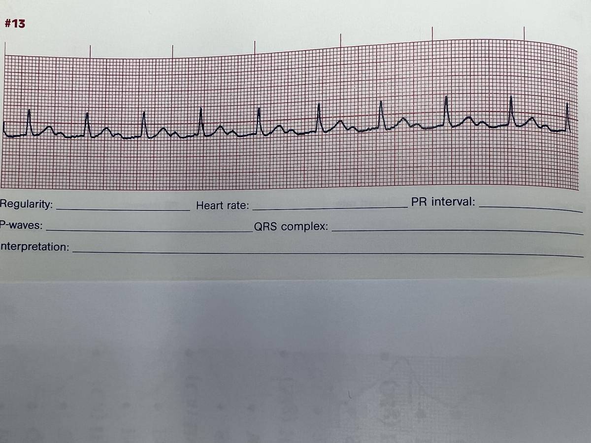 Analyze the provided ECG strip and determine the following: Regularity